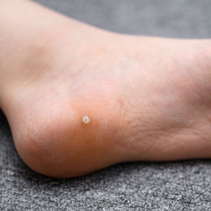 Common Skin Conditions: What's Contagious and What's Not? - Bryn Mawr ...