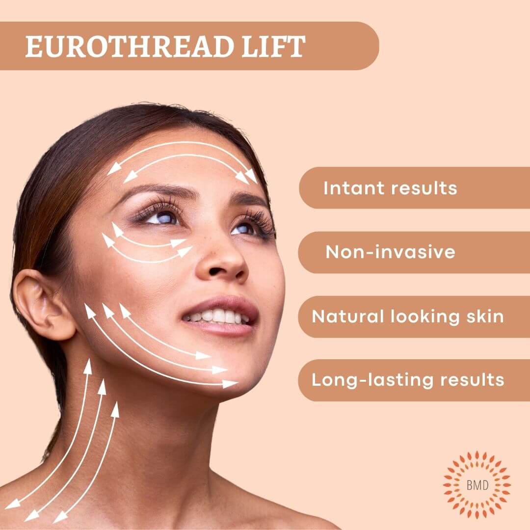 No Surgery Needed: Lift and Tighten Skin with a EuroThread Lift