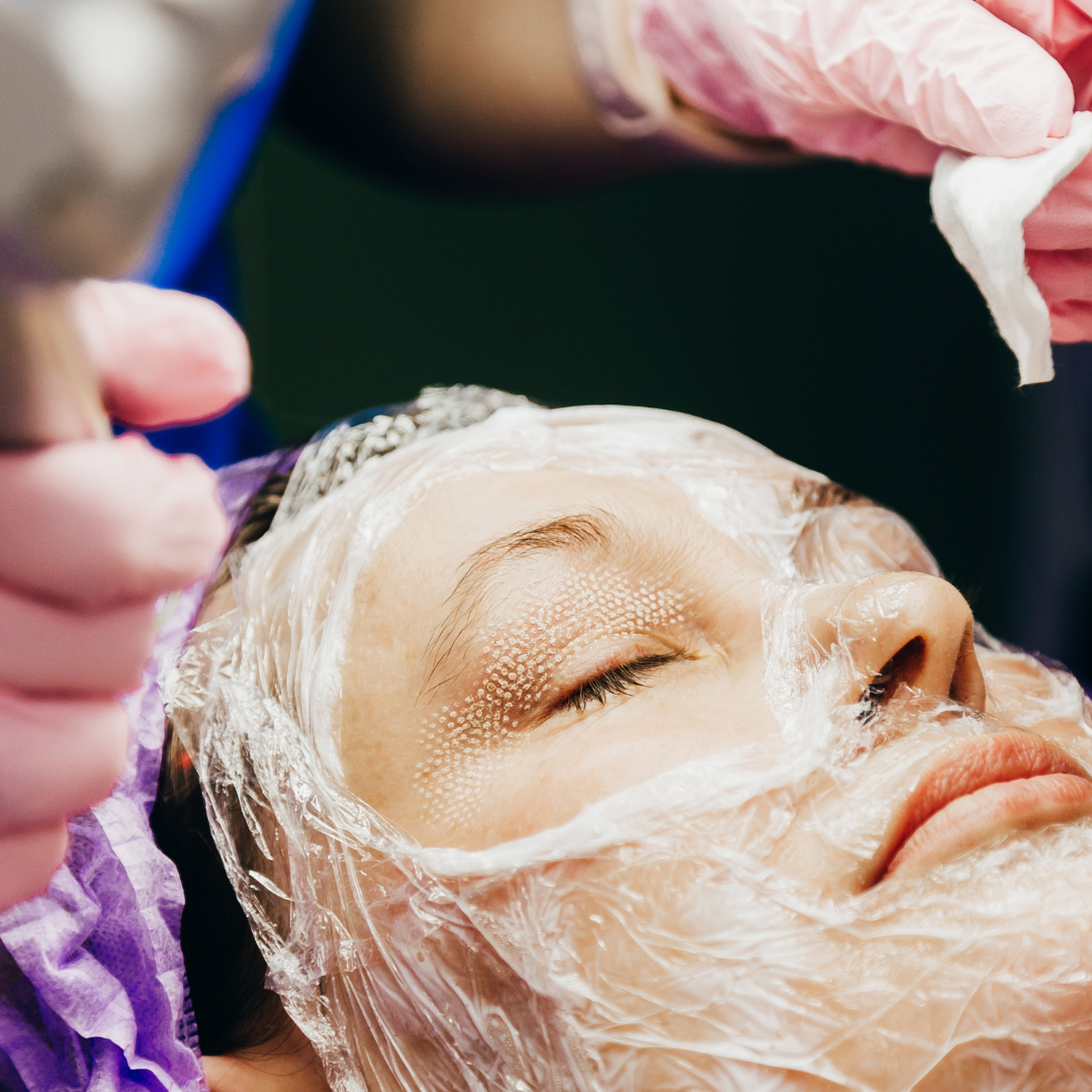 Discover the Benefits of CO2 Laser Skin Resurfacing at BMD in Pennsylvania