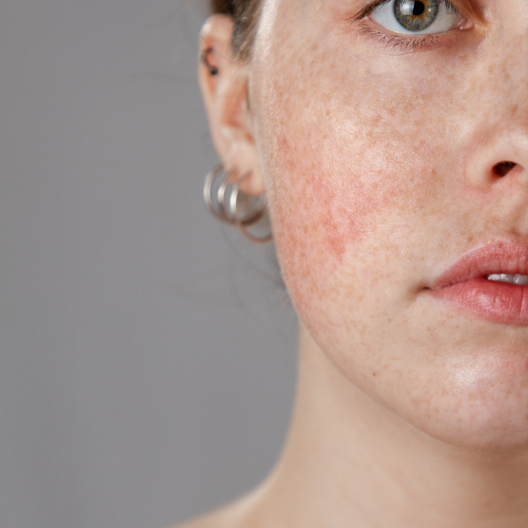 Pediatric Dermatology: 10 Common Skin Conditions in Children