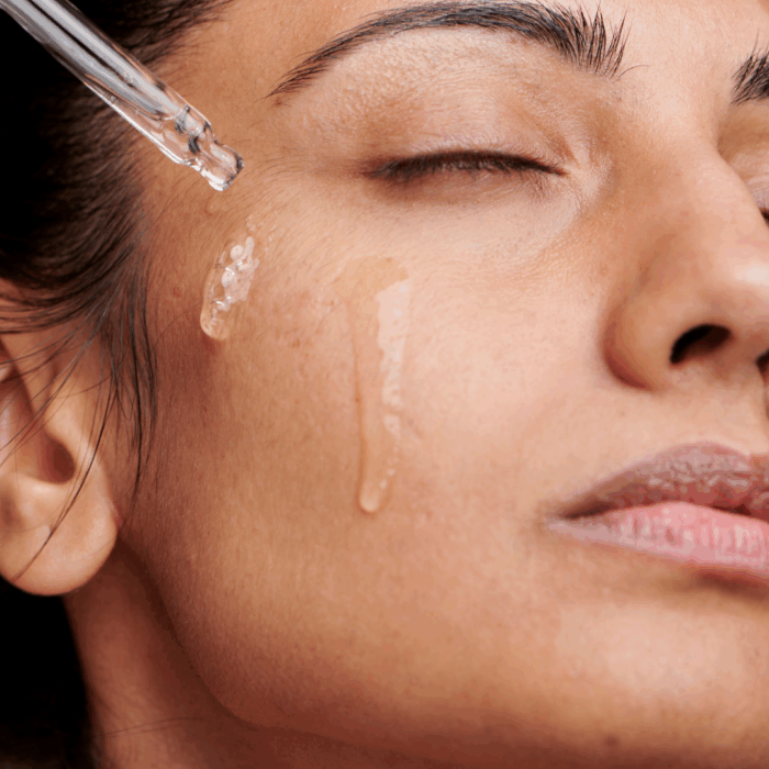 How Spring Sun Can Trigger Melasma, Sunspots, and Pigmentation